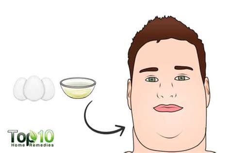 How To Get Rid Of Neck Fat Top 10 Home Remedies