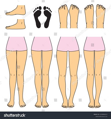 Bow Legged