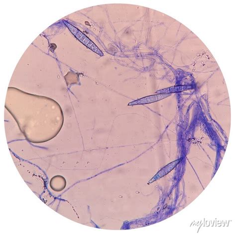 Microscopic Finding Shows Macroconidia Of Microsporum Canis In Wall