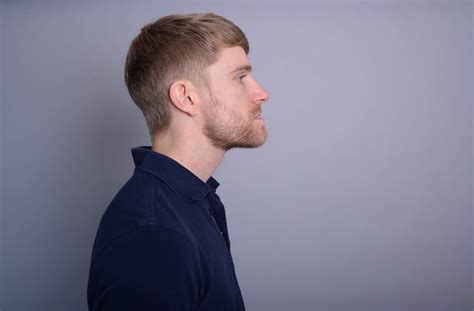 Medial Pterygoid Pain And Trigger Points