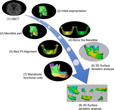 Figure 1 From Introducing Surface To Surface Matching Technique To