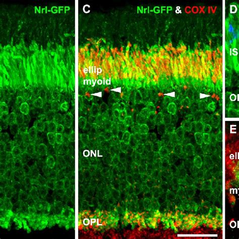The Relative Location Of The Rod And Cone Outer Segments And Myoid And