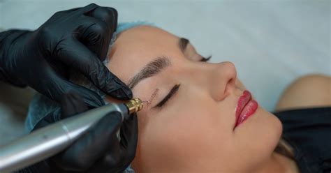 Eyelid Lift Without Surgery A Non Invasive Transformation 2025