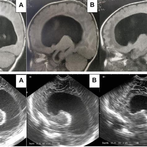 The Ability Of Ultrasound To Capture Images At Different Sagittal