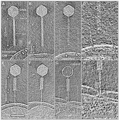 Electron Microscope Bacteriophage