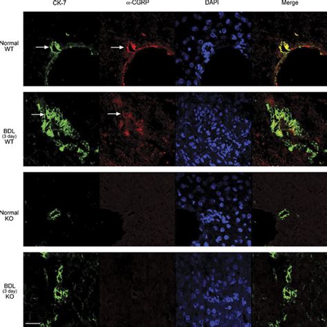 The Cgrp Receptor Components Clr Rcp And Ramp 1 Were Expressed By Download Scientific