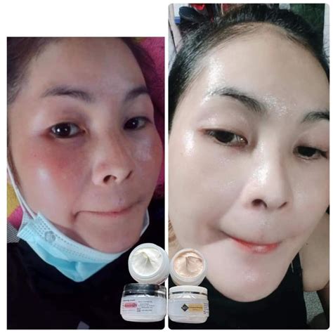 Mnຄີມລະເບີດຝ້າ ຝ້າຫາຍຖາວອນ 💯 ນາງ ບຸນທຽມ ປັນຍາລັກ