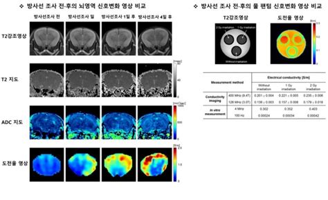 방사선 암癌 치료 후 조직 변화 명확히 파악 가능