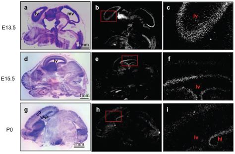 Mcph1 Mgi Mouse Gene Detail Mgi2443308 Microcephaly Primary