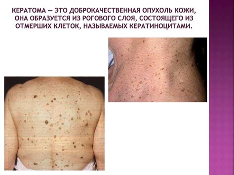 Внешние проявления различных патологических состояний презентация онлайн