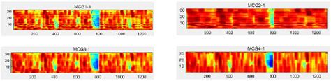 Figure 1 From Learning Emotion Information For Expressive Speech Synthesis Using Multi