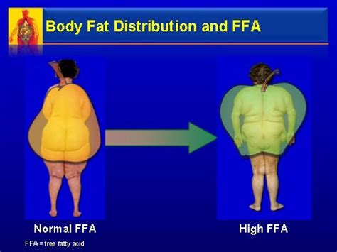 Diabesity Diabetes And Obesity Ppt