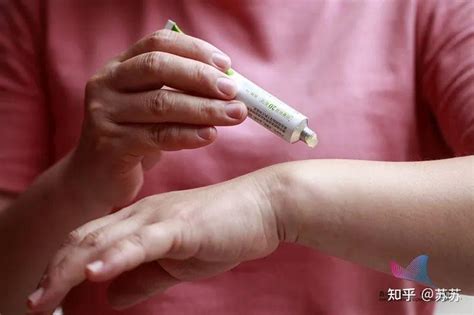几块钱一支的红霉素眼膏，到底能治多少病？与红霉素软膏有啥区别？答案来了 知乎