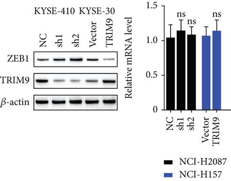 Trim9 Inhibits Esophageal Cancer Cell Migration And Invasion By