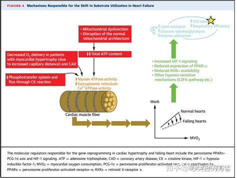 心肌代谢的治疗手法 知乎