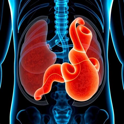 Icd 10 Code For Left Otitis Externa A Comprehensive Guide Wmwtl