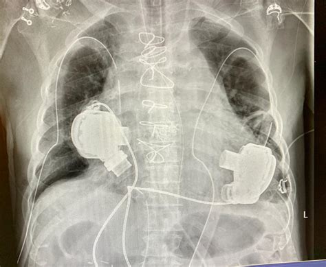 Harald C Eichstaedt On Linkedin Sometimes It Takes Two If You Look Closely You Will