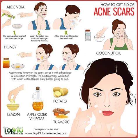 How To Remove Old Pimple Marks From Face At Jean Shaffer Blog