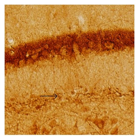 Magnified Image Of Calretinin CR Immunoreactivity IR In The