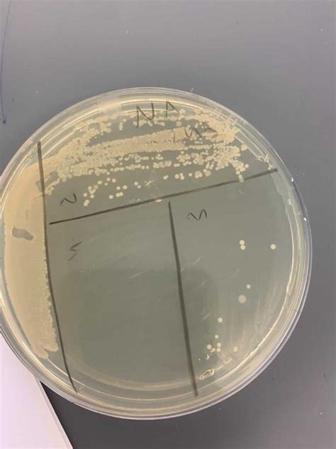 Solved Appearance Of Streak Plate Mixed Culture Of Chegg