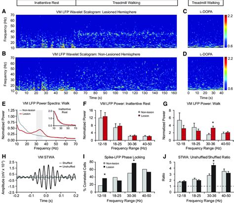 Lfp Power In Paired Recordings From The Vm In Nonlesioned And Dopamine Download Scientific