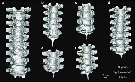 Three Dimensional Isosurface Renderings Anterior View Derived From