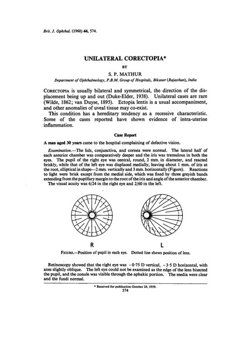 Unilateral Corectopia British Journal Of Ophthalmology