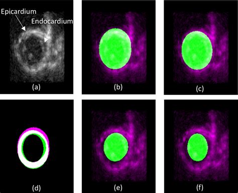 Segmentation Of The Left Ventricle Of The Heart From A 2d Time Download Scientific Diagram