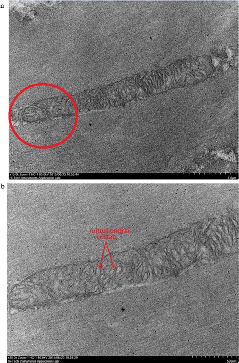Transmission Electron Microscope Tem Micrographs Showing A Download Scientific Diagram