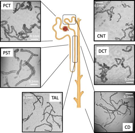 Schematic Representation Of A Nephron With Pictures Of Different