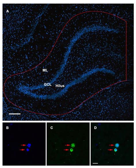 Tunel Labeled And Dapi Stained Nuclei Of The Rat Dentate Gyrus A