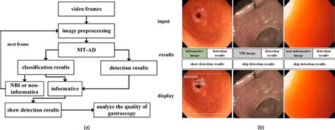 Upper Gastrointestinal Anatomy Detection With Multitask Convolutional