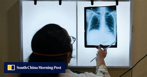 Is India Losing Its Fight Against Tuberculosis Eradication By 2025 South China Morning Post