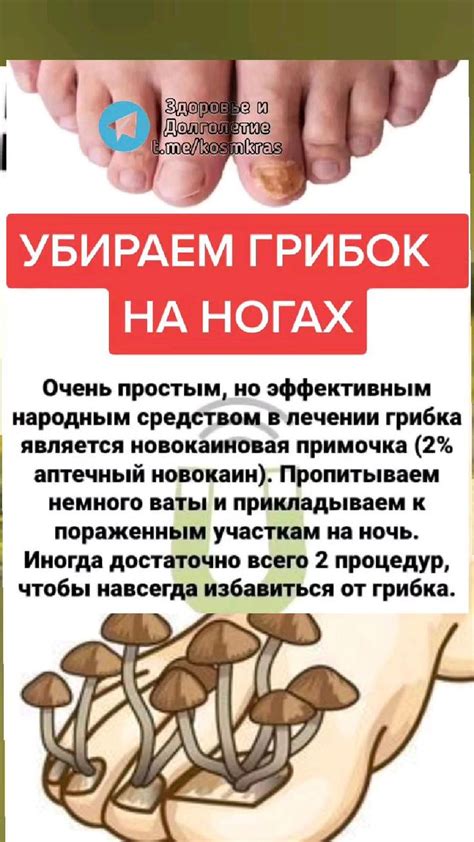 убираем грибок на ногах