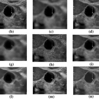 Denoised Image Outputs Using Different Filtering Algorithms For Real