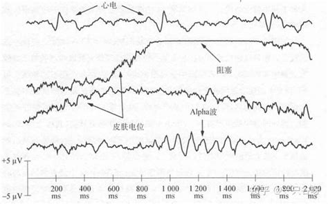 Eeg常见伪迹类型 知乎