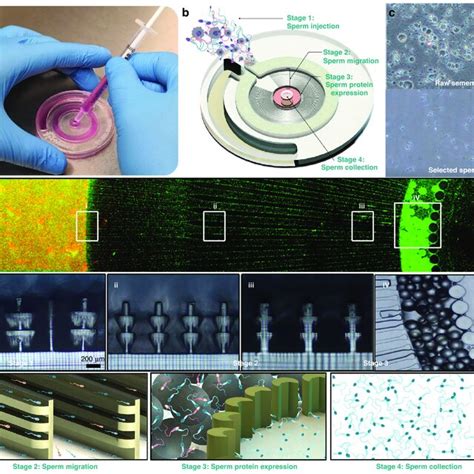 Sperm Assessments Before And After Su And Microfluidic Sperm Selection Download Scientific