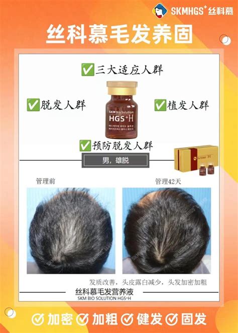 发质受损为什么会脱发呢 哔哩哔哩