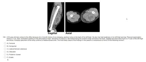 Solved Are Shown A Biopsy Specimen Of The Lump Confirms A