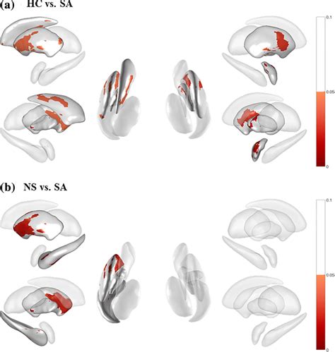 Comparison Of Subcortical Local Shape Volumes Between Groups A Shape Download Scientific