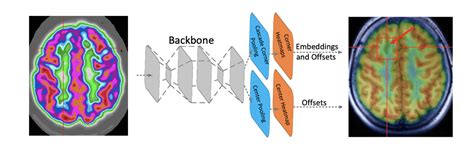 Machine Learning For Improved Clinical Decision Making Ahead Of