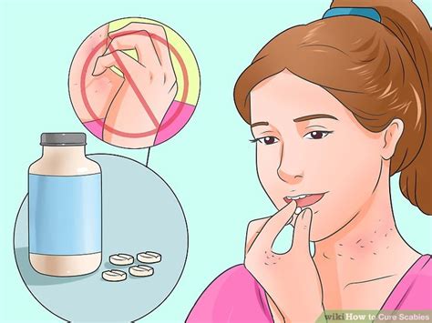 EASY TUTORIAL HOW GET SCABIES Tutorial