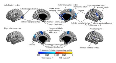 Positive Modulations Of Structural Covariance Networks By Sleep