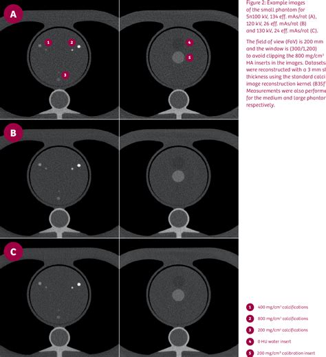 Figure 2 From Tin Filter Spectral Shaping A Demonstration Of Agatston Equivalence Calcium