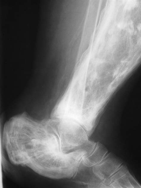 Ucsd Musculoskeletal Radiology