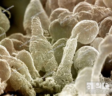 Scanning Electron Micrograph Sem Human Retina Showing Photoreceptors