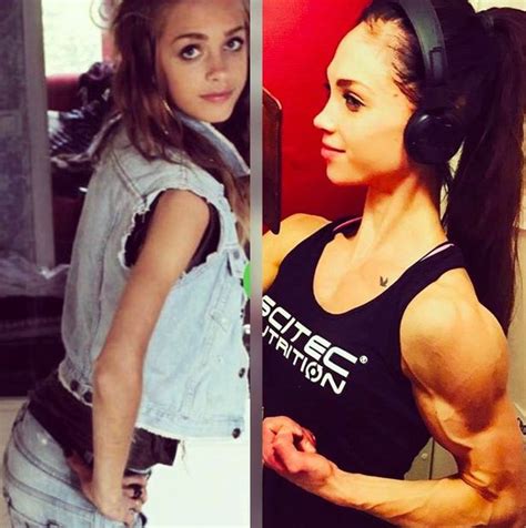 Suicidal Anorexia Sufferer Who Weighed Less Than Six Stone Defeats