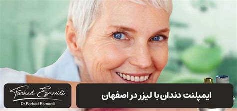 ایمپلنت دندان با لیزر در اصفهان قیمت ایمپلنت سال 1401 دکتر فرهاد اسماعیلی