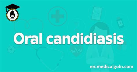 Oral Candidiasis Medical Gurukul Goln English