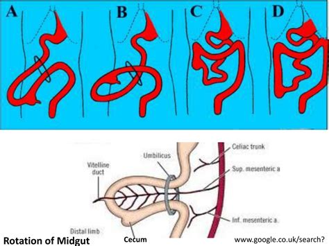Ppt Embryology Of The Midgut And Hind Gut Powerpoint Presentation